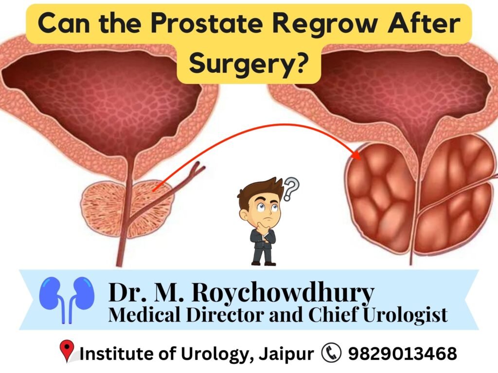 Can The Prostate Regrow After Prostate Surgery 7750